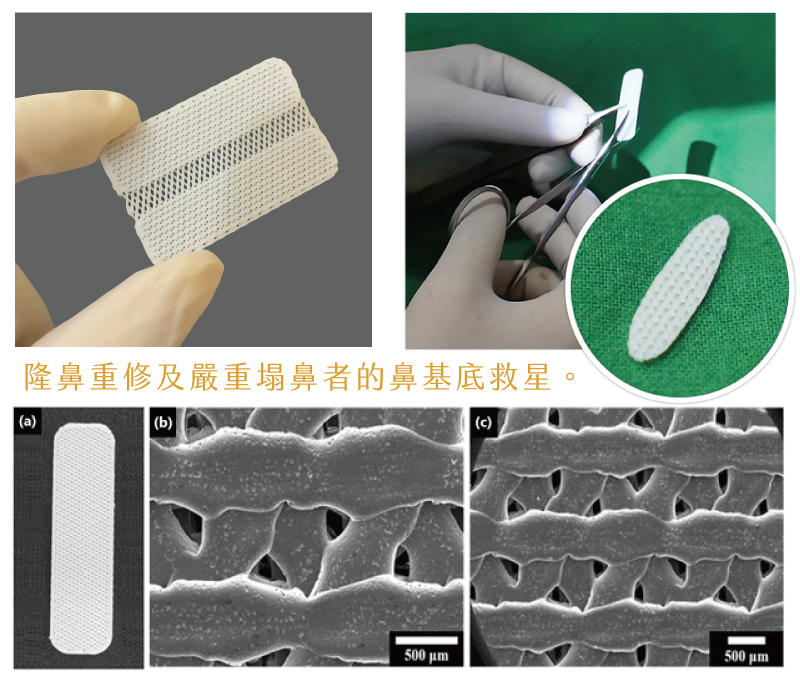 OSTEOPORE™奧世博骨骼填充物，打造自然動態翹挺鼻 - 大師美學診所｜崇尚自然美學、打呼鼻塞治療、自律神經疼痛治療、私密性福診所