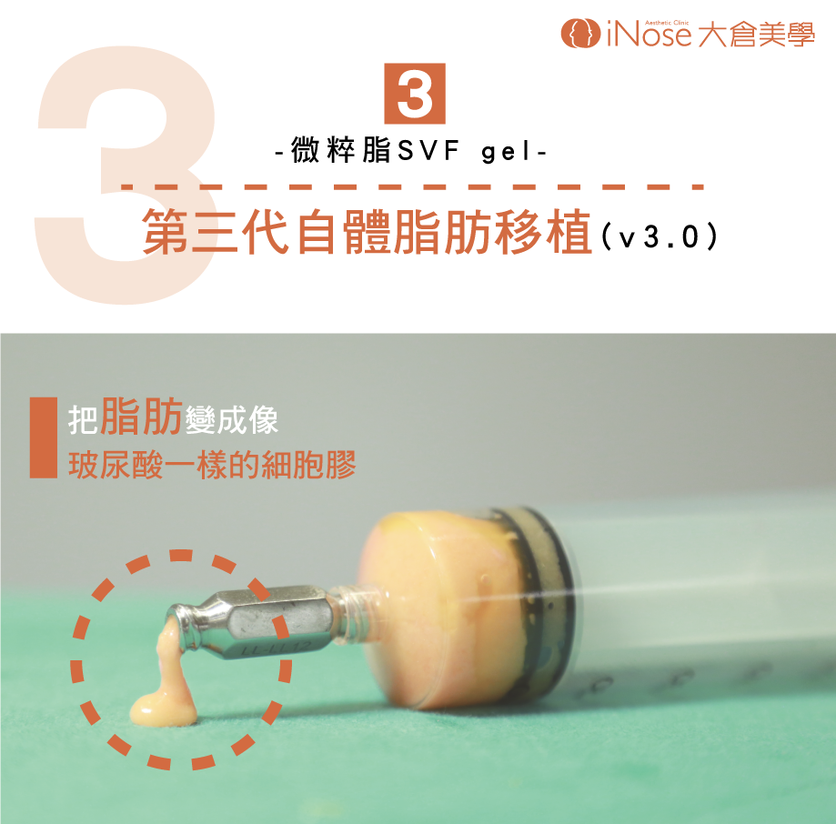 SVF-GEL 神奇的脂肪幹細胞膠 - 大師美學診所｜崇尚自然美學、打呼鼻塞治療、自律神經疼痛治療、私密性福診所